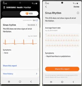 How to Check ECG on Your Samsung Galaxy Watch